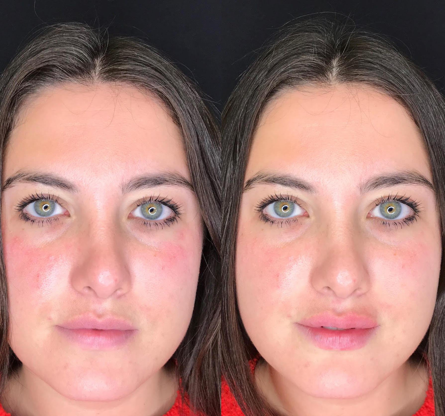 Treatment Gallery | Omniya Clinic London