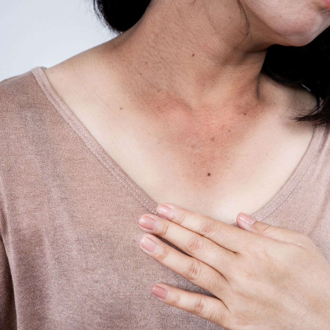 Treatments to Repair Sun Damaged Skin | Omniya Clinic London