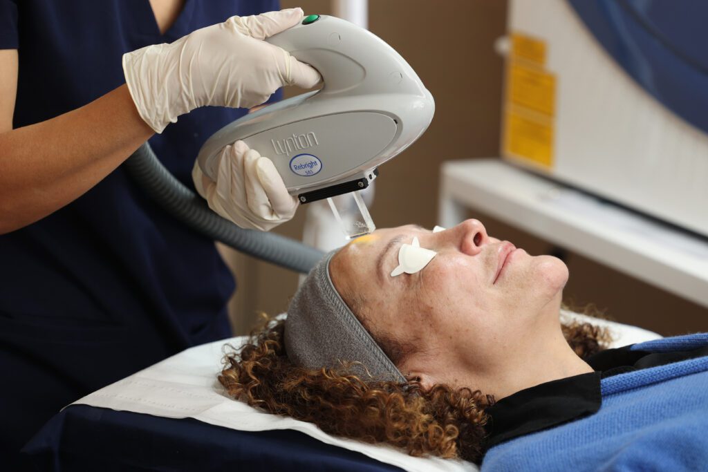 IPL Skin Rejuvenation London | Flawless Skin | Omniya Clinic